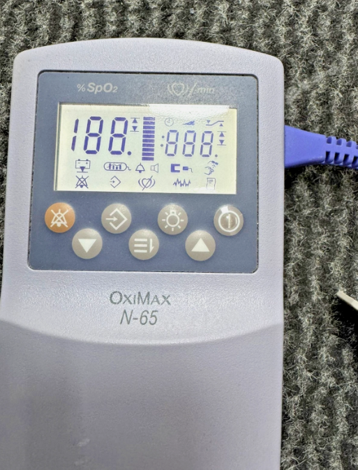 Nellcor Oximax N-65 Pulse Oximeter - Wynne Optics